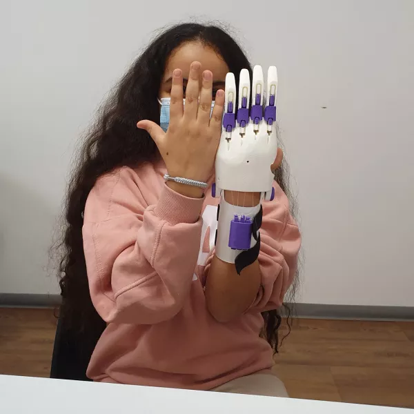 Prothèse de main réalisée par impression 3D : une solution accessible ...